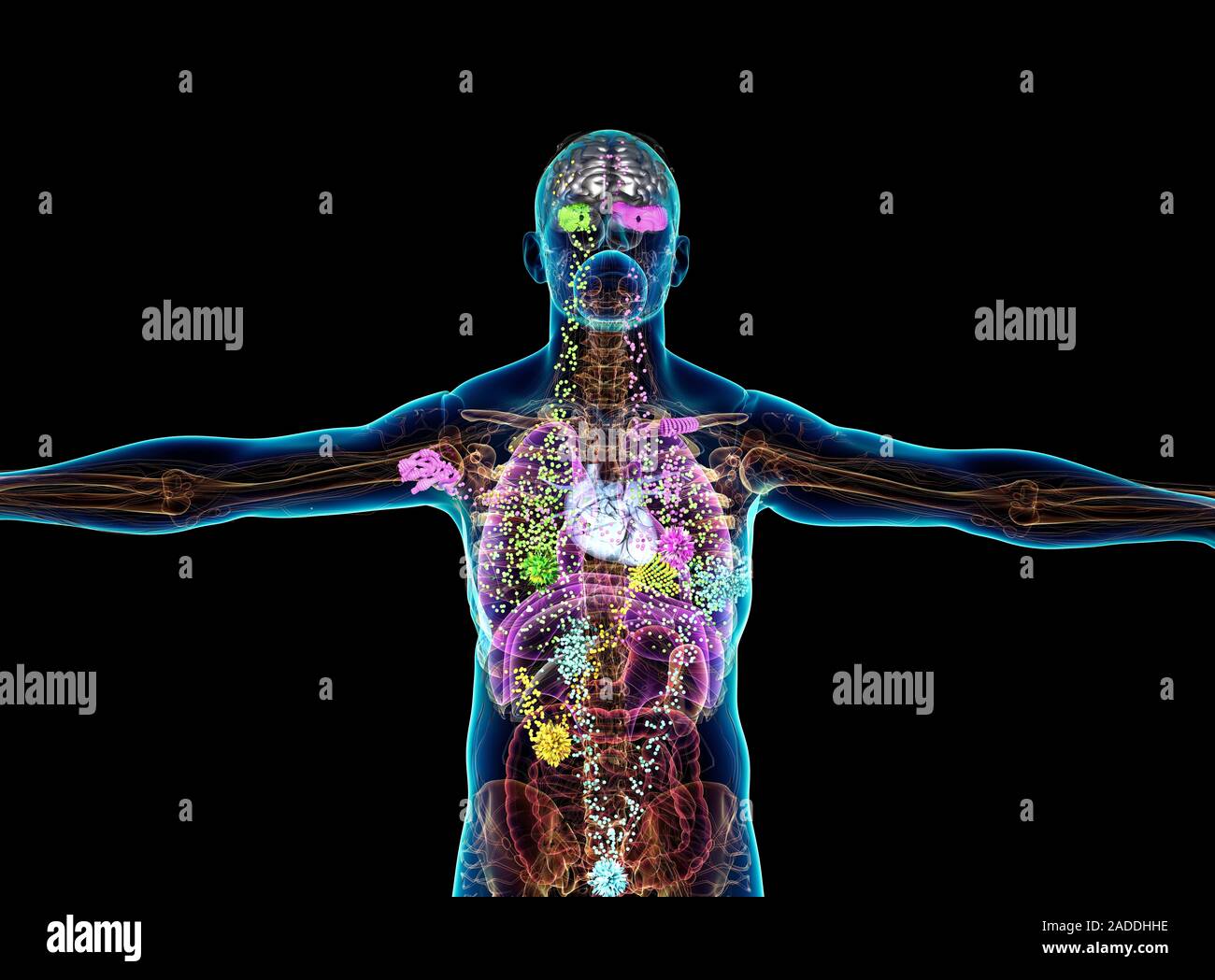 Cancer metastasis. Illustration of cancer cells (blue, yellow, pink and ...