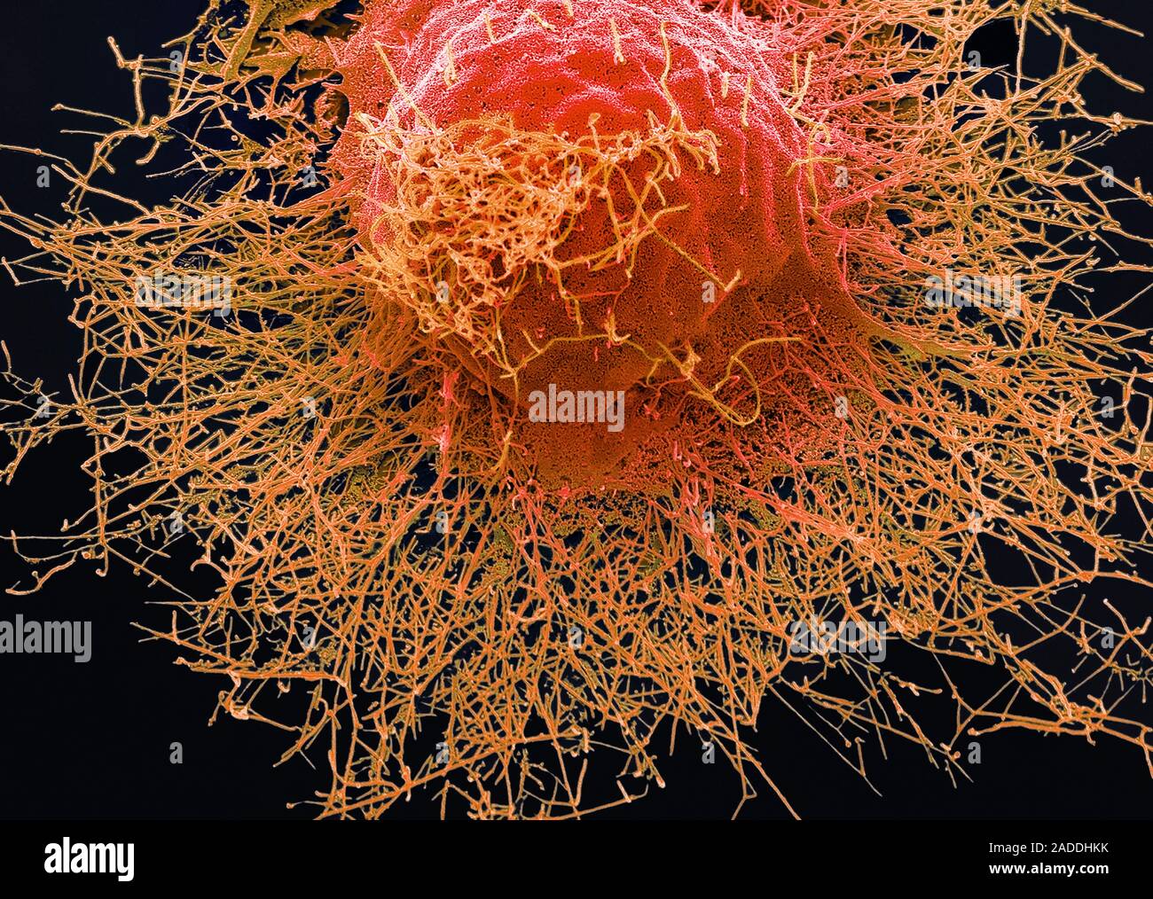 Coloured scanning electron micrograph (SEM) of a human cell infected ...