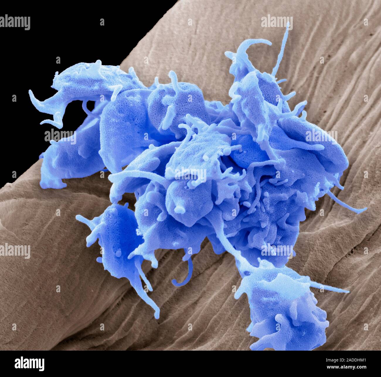 Activated platelets. Coloured scanning electron micrograph (SEM) of ...