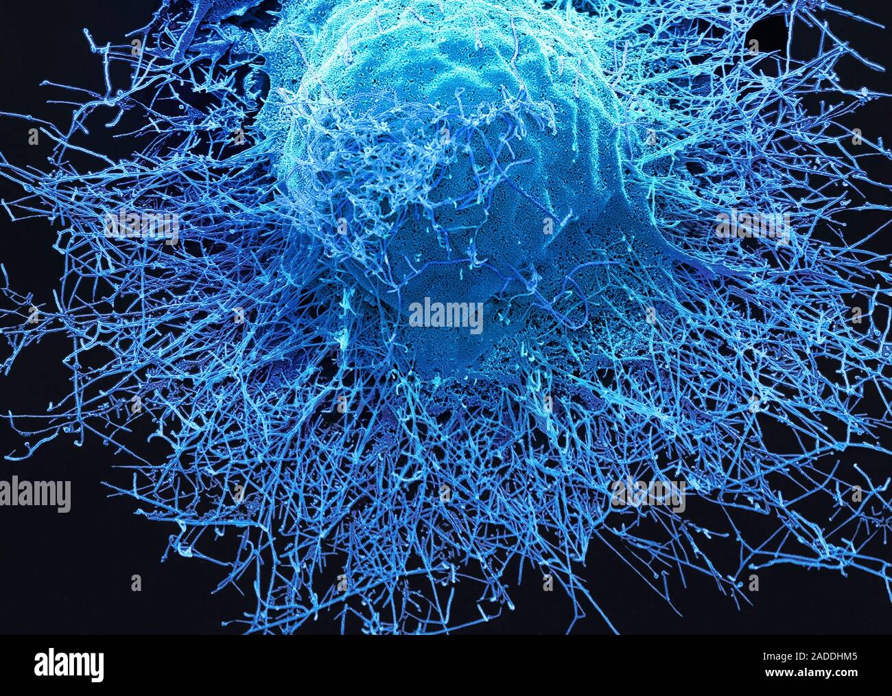 Coloured scanning electron micrograph (SEM) of a human cell infected ...