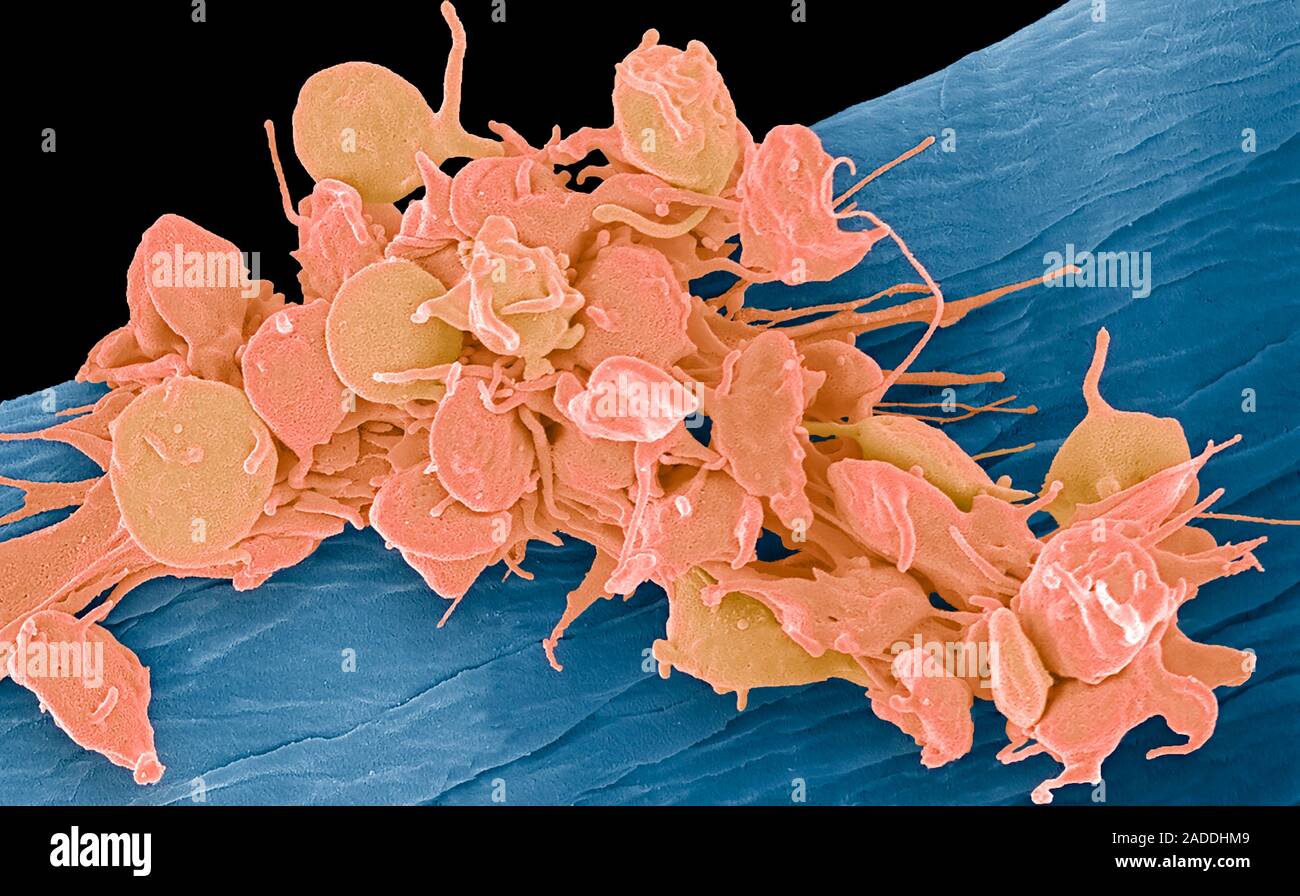 Activated platelets. Coloured scanning electron micrograph (SEM) of ...