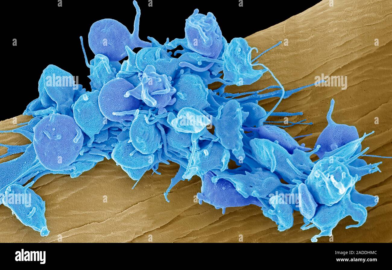 Activated platelets. Coloured scanning electron micrograph (SEM) of ...