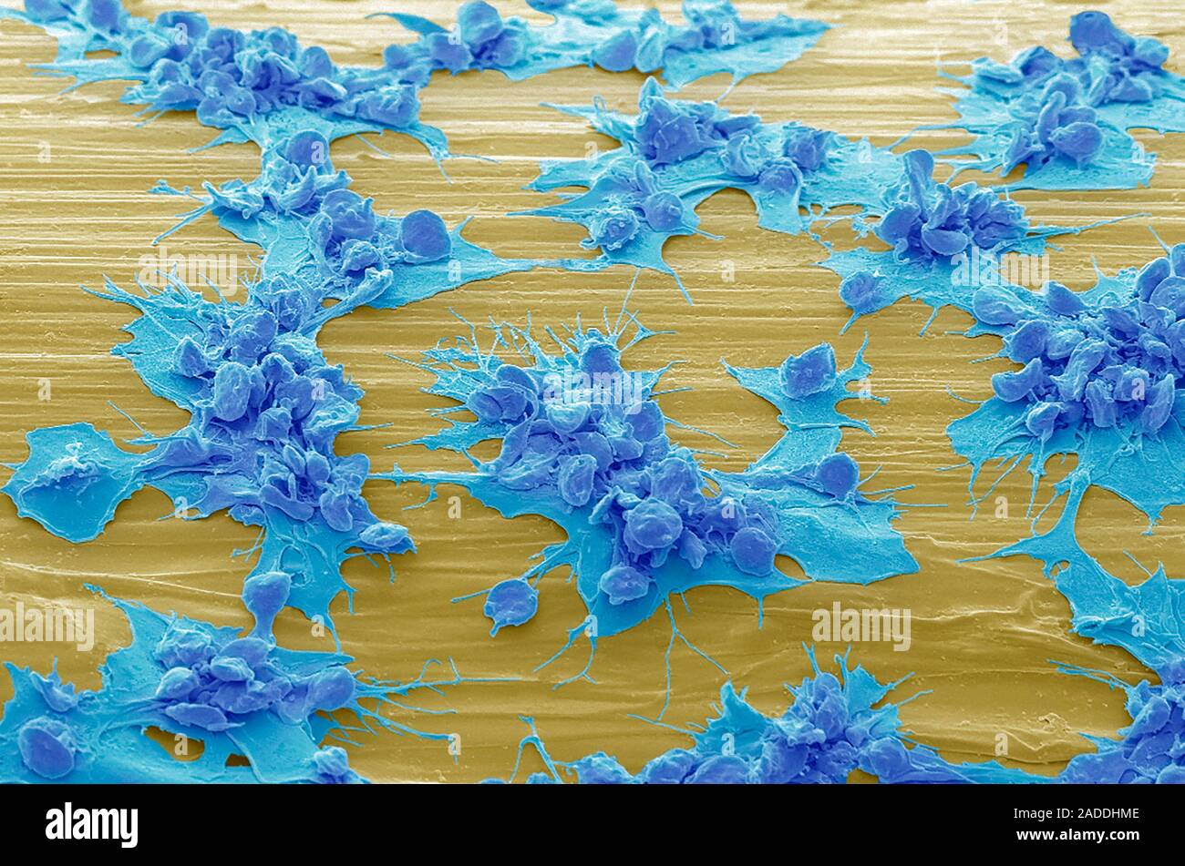 Activated platelets. Coloured scanning electron micrograph (SEM) of ...