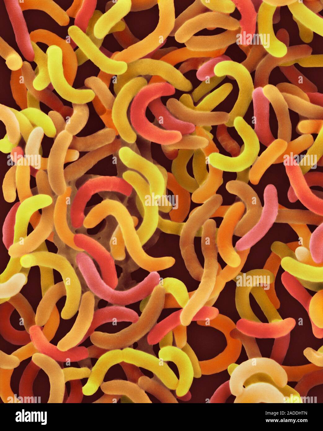 Coloured scanning electron micrograph (SEM) of Vibrio cholerae bacteria ...