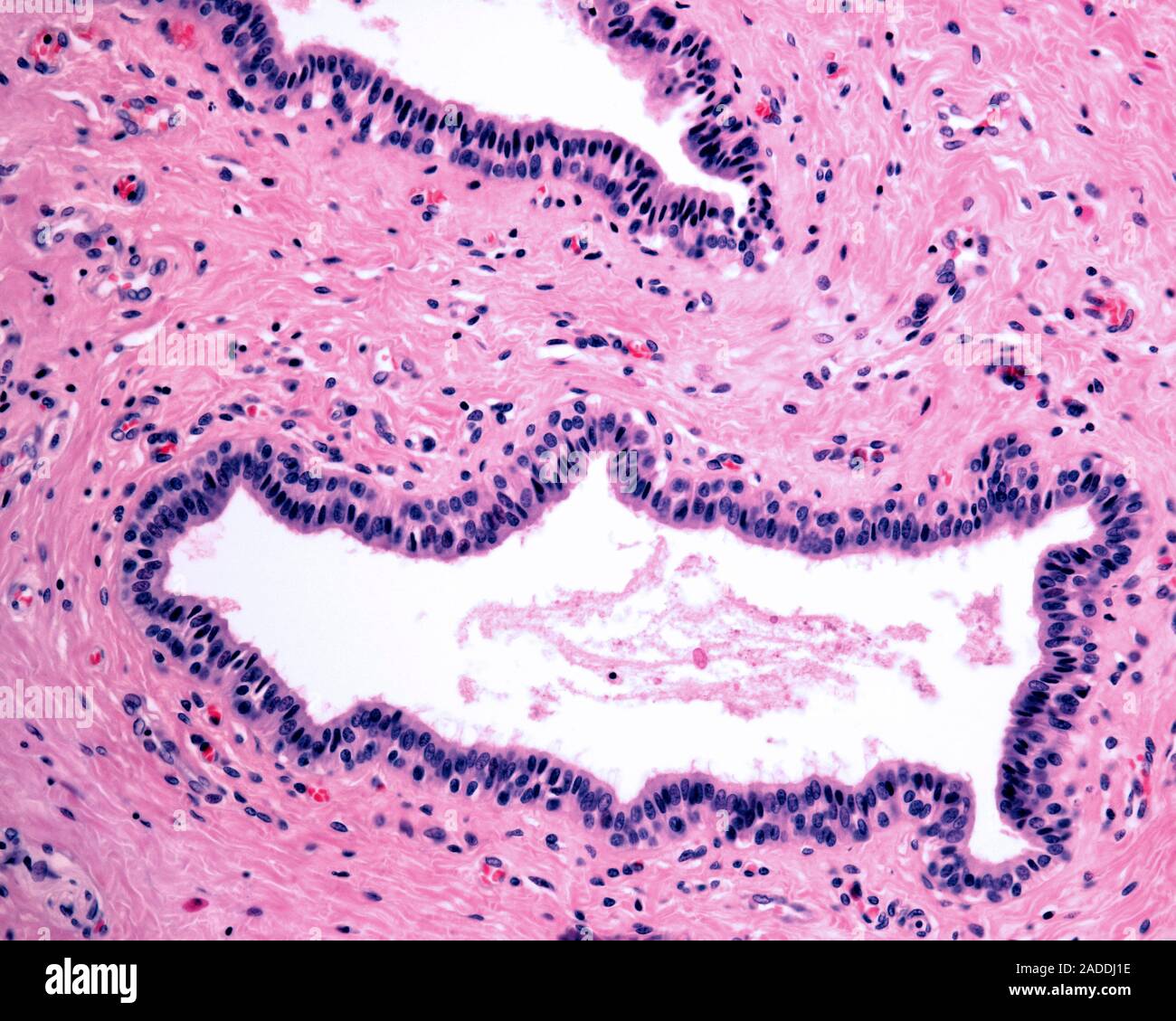 Light micrograph of a section through excretory ducts from a human ...