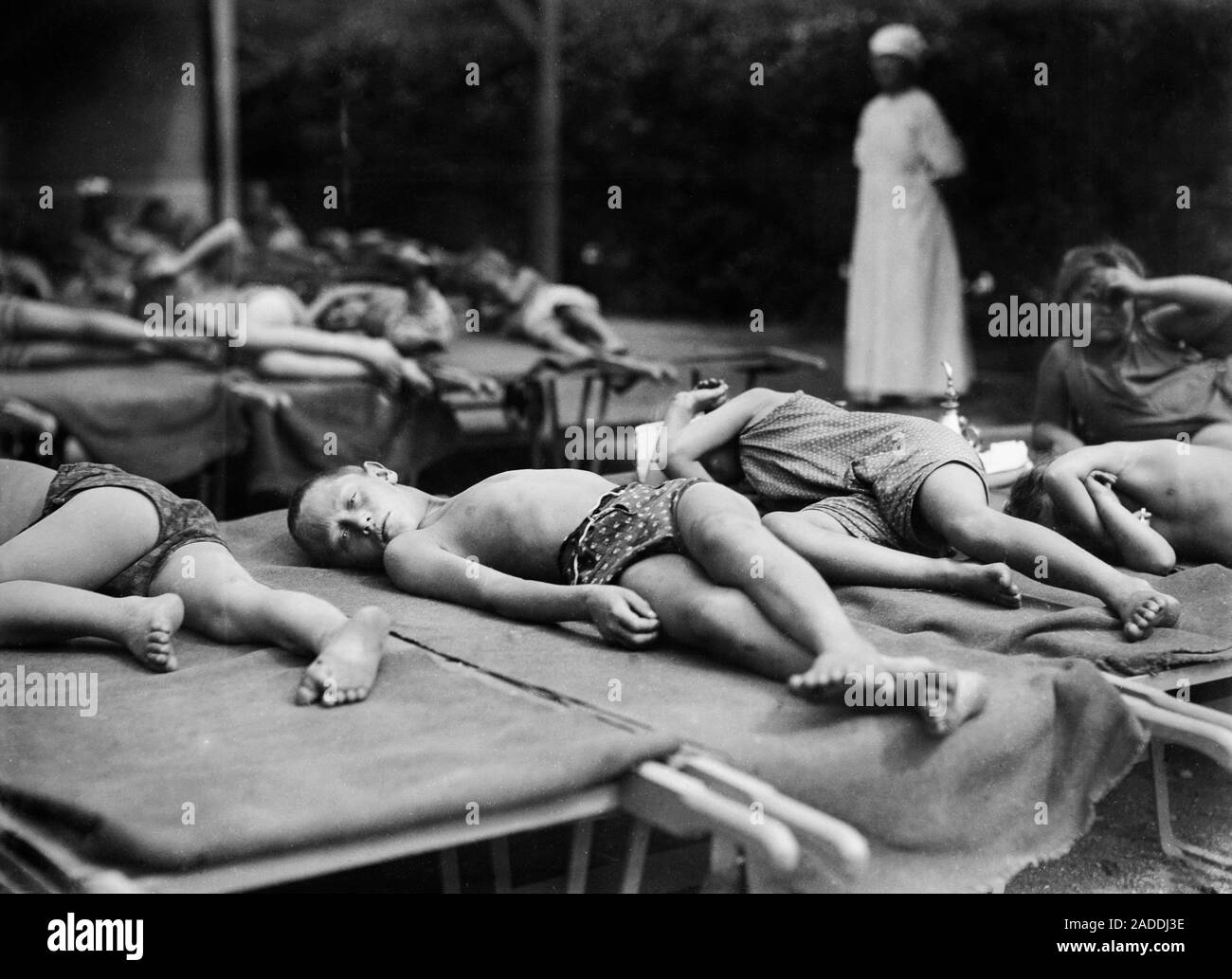 Children with tuberculosis lie in the sun to aid recovery at a clinic ...