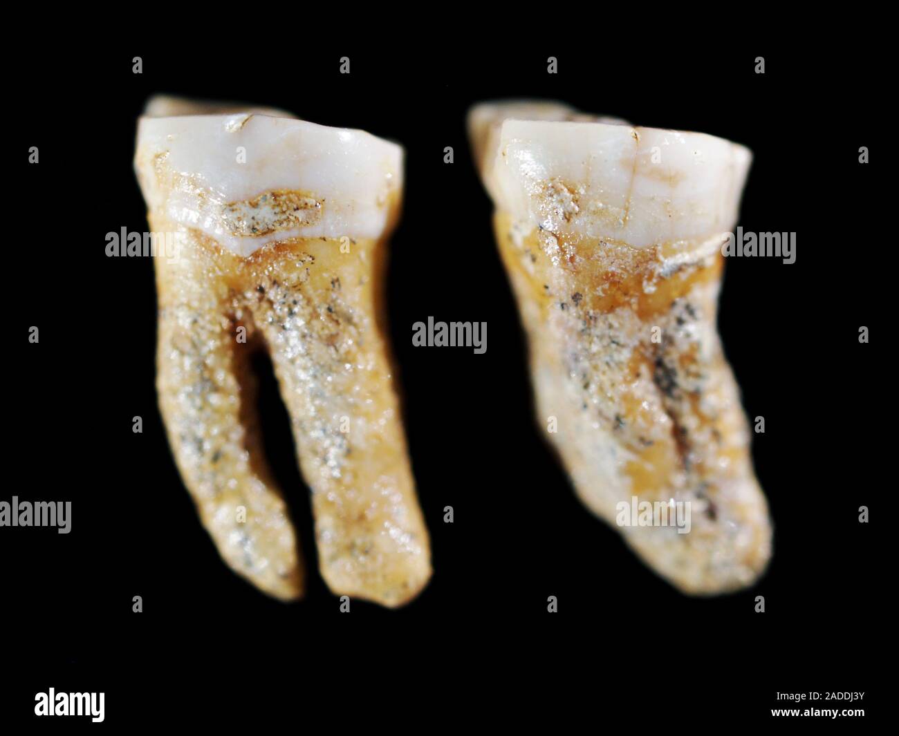 Neanderthal teeth. These teeth are molars from a Neanderthal individual ...