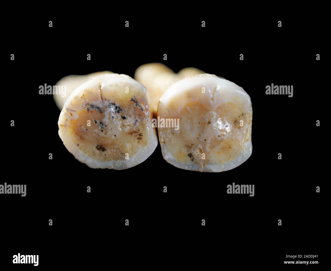 Neanderthal teeth. These teeth are molars from a Neanderthal individual ...