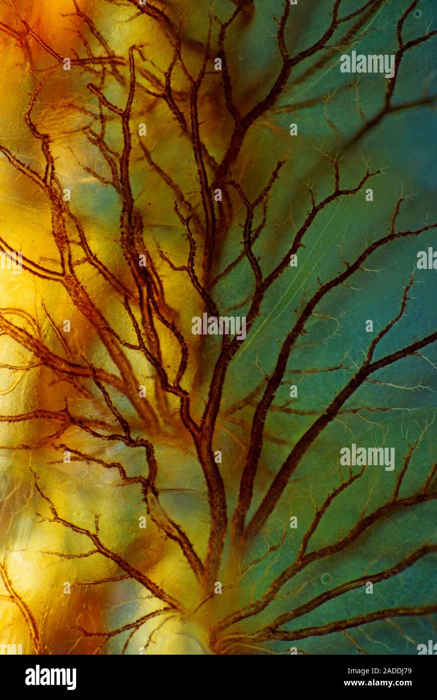 Mayfly larva gills. Polarised light micrograph of a section through a ...