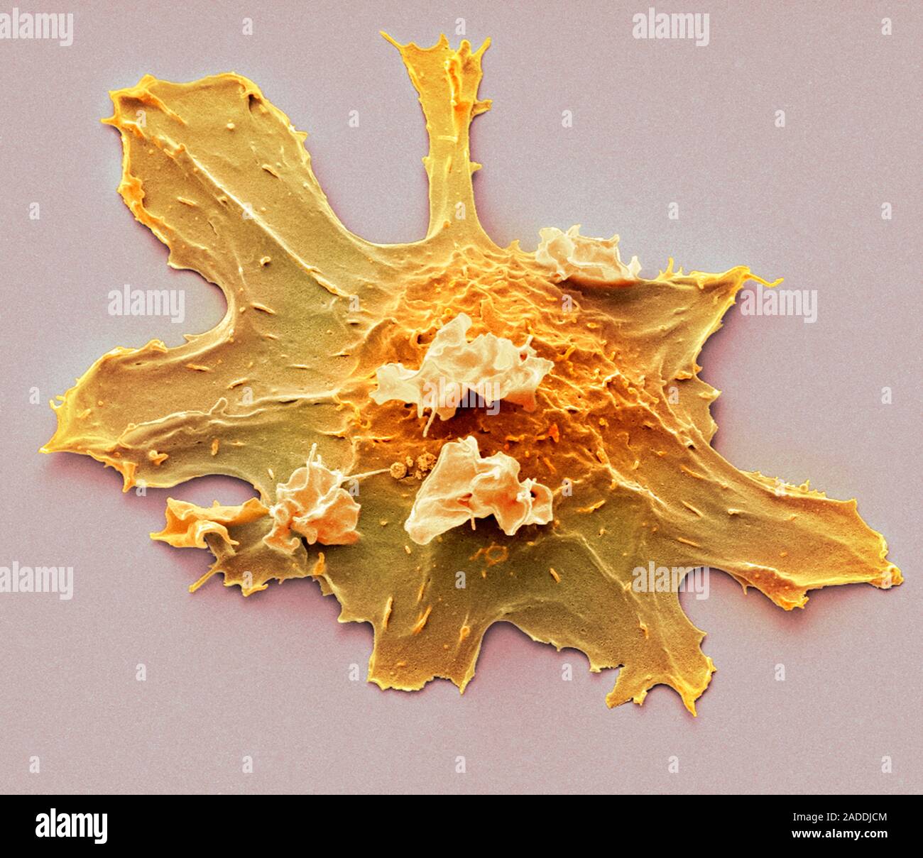 Jurkat cell. Coloured scanning electron micrograph (SEM) of a Jurkat ...