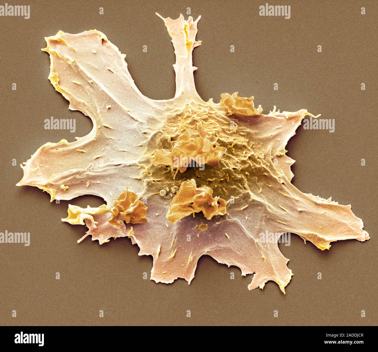 Jurkat cell. Coloured scanning electron micrograph (SEM) of a Jurkat ...