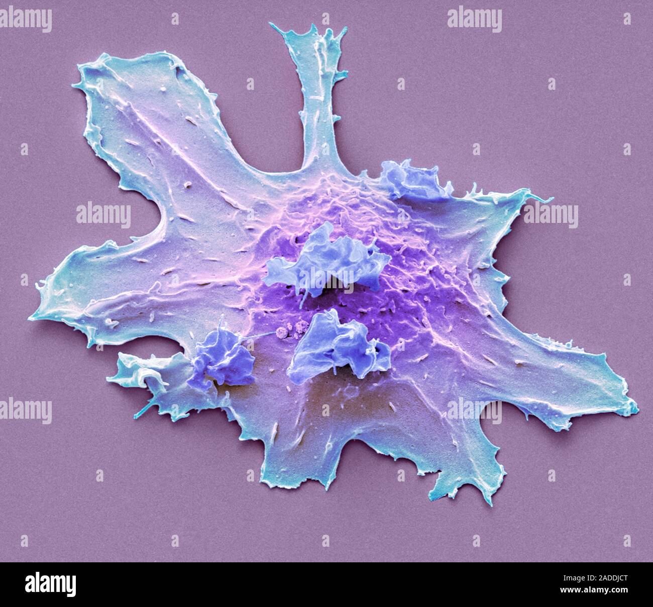 Jurkat cell. Coloured scanning electron micrograph (SEM) of a Jurkat cell. The Jurkat cell line ...