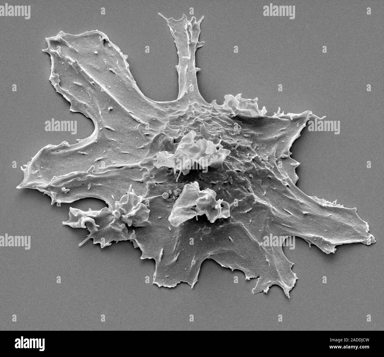 Jurkat cell. Black and white scanning electron micrograph (SEM) of a Jurkat cell. The Jurkat ...