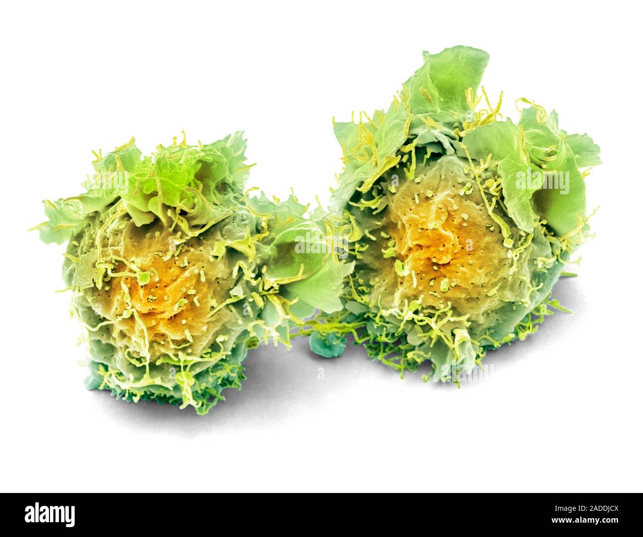 Jurkat cell. Coloured scanning electron micrograph (SEM) of dividing ...