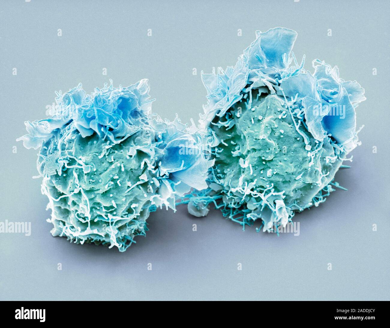 Jurkat cell. Coloured scanning electron micrograph (SEM) of dividing ...