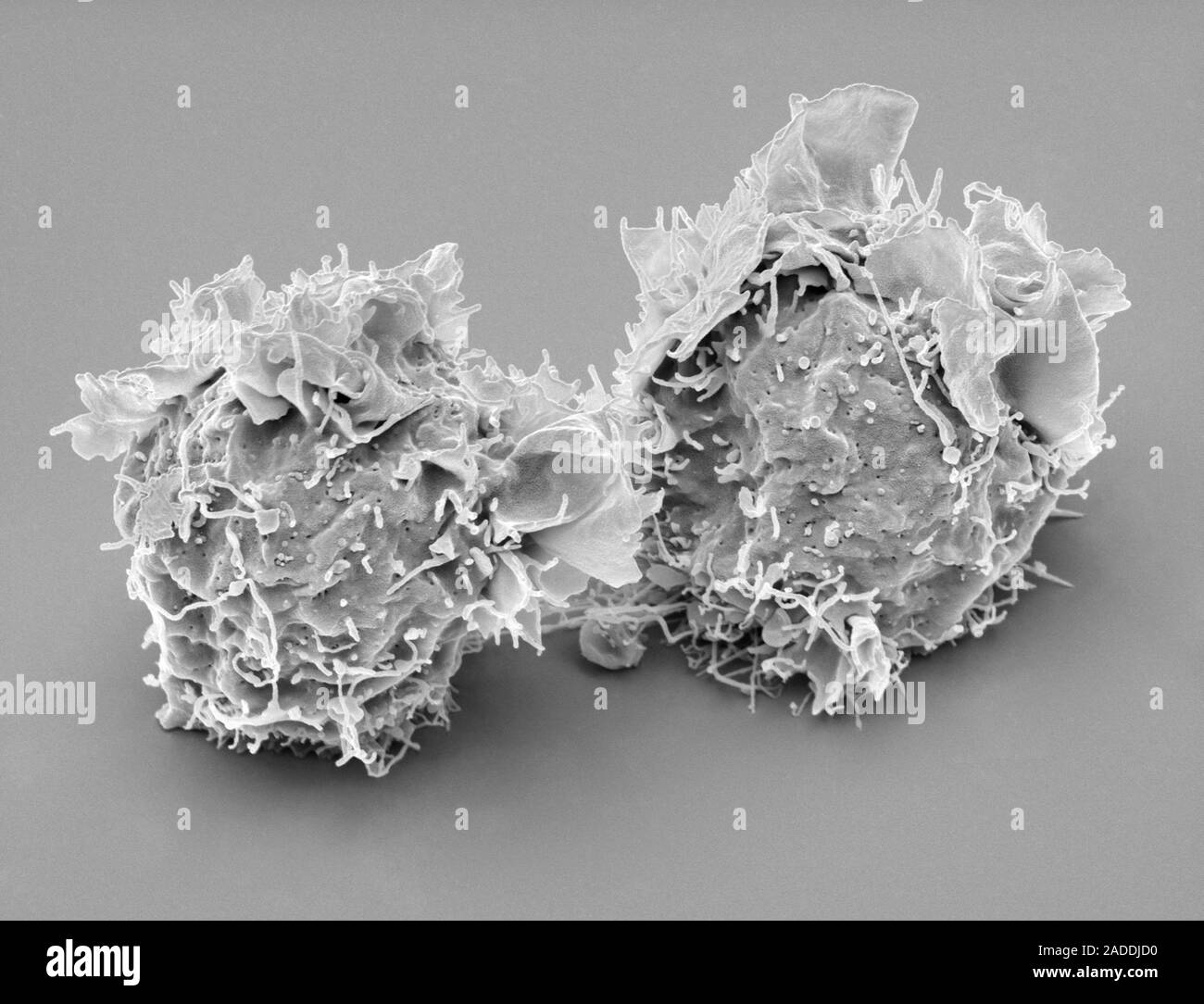 Jurkat cell. Black and white scanning electron micrograph (SEM) of ...