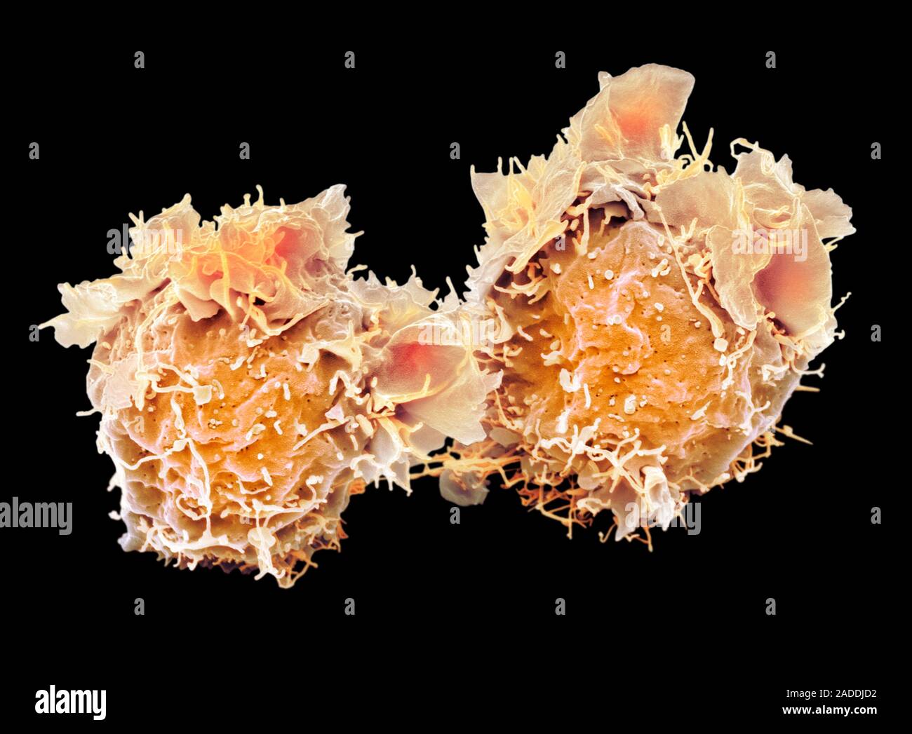 Jurkat cell. Coloured scanning electron micrograph (SEM) of dividing ...