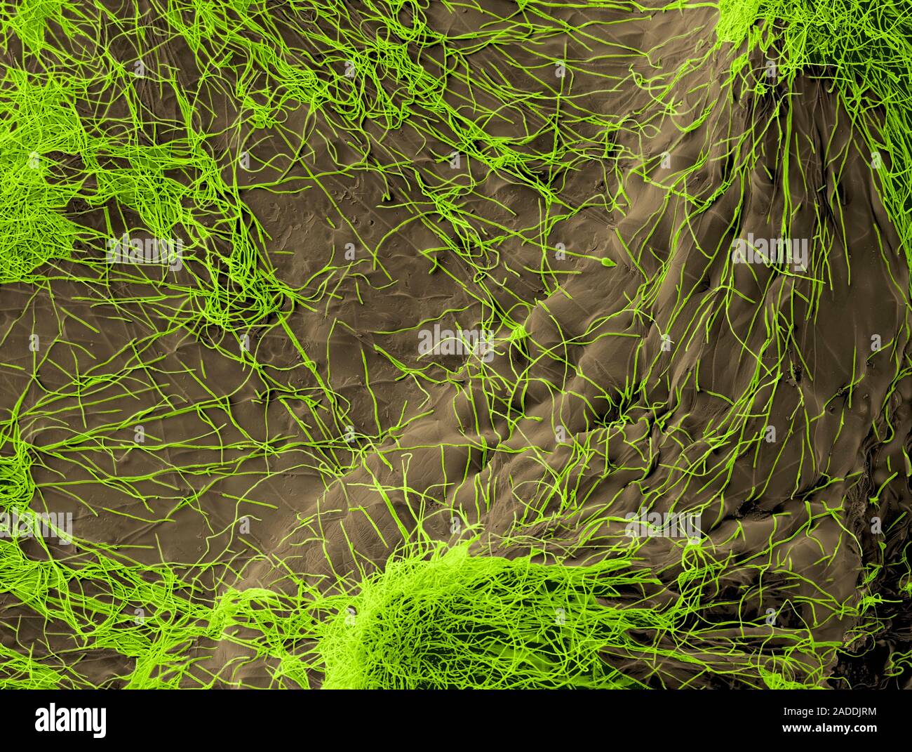 Trichophyton fungus, coloured environmental scanning electron ...