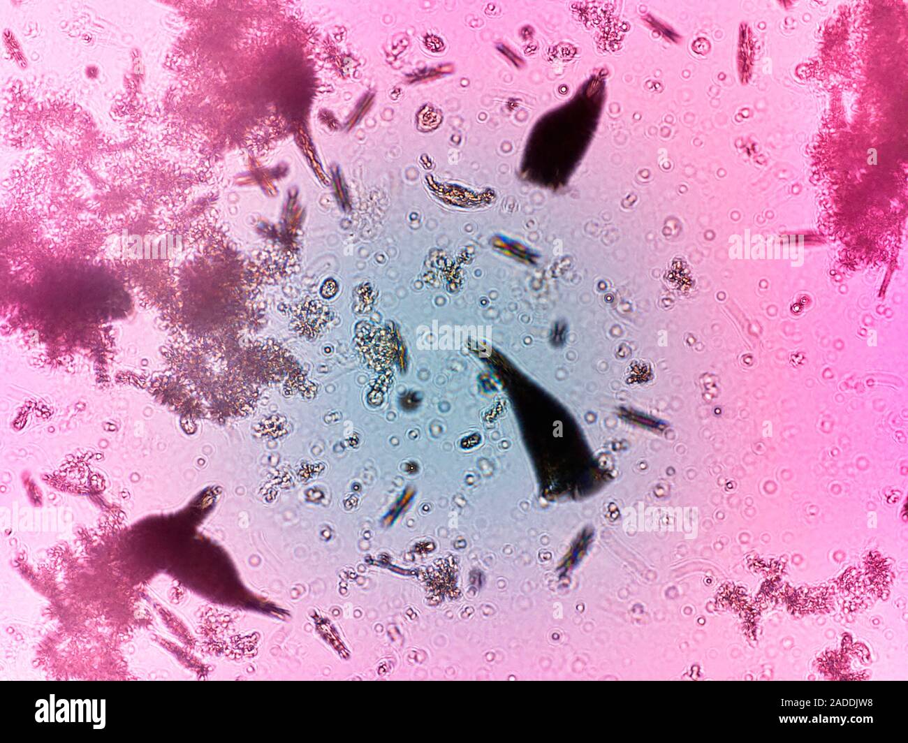 Plankton under IBM autonomous microscope. Variety of plankton seen ...
