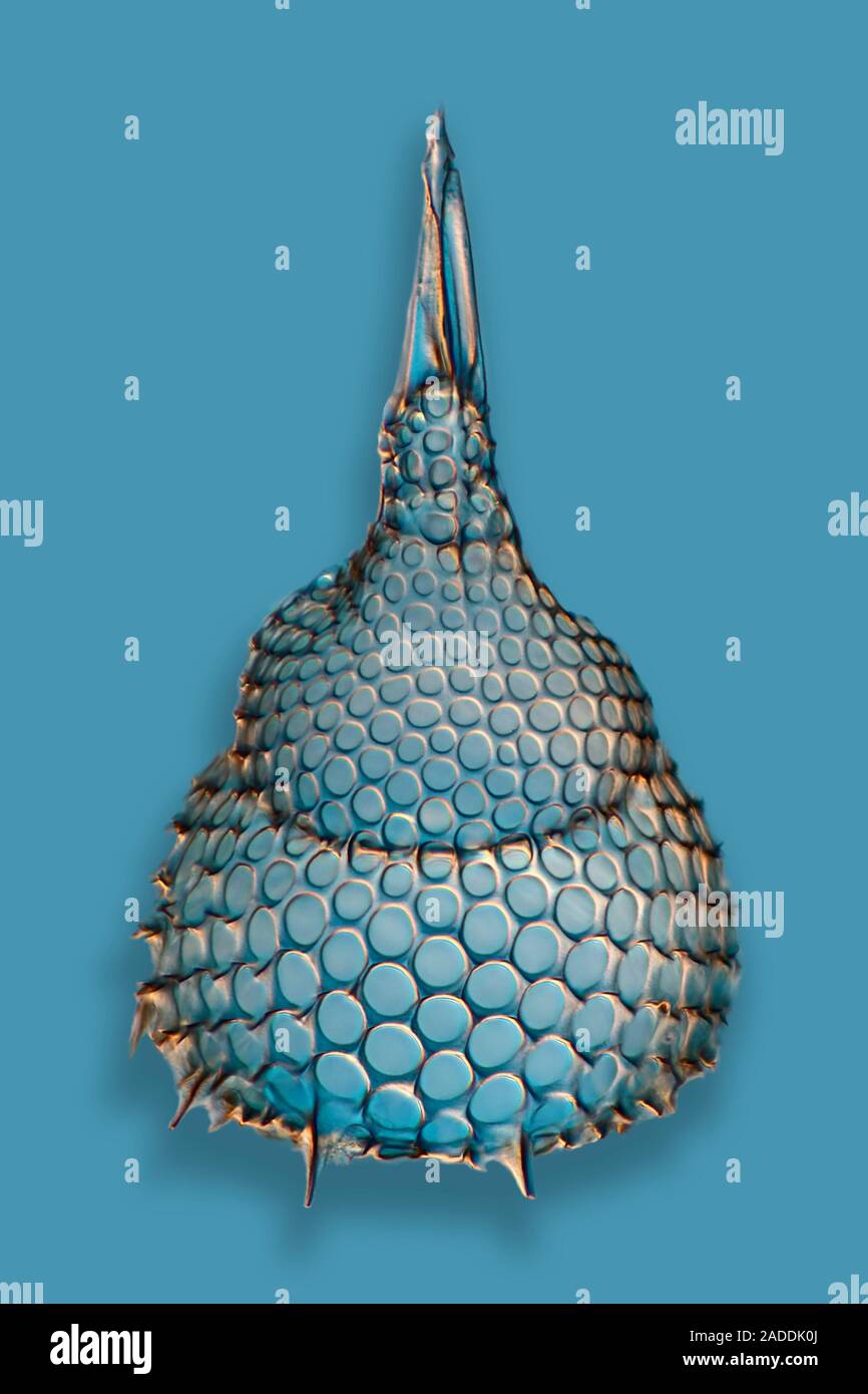 Radiolarian protozoan. Rheinberg illuminated light micrograph of the ...