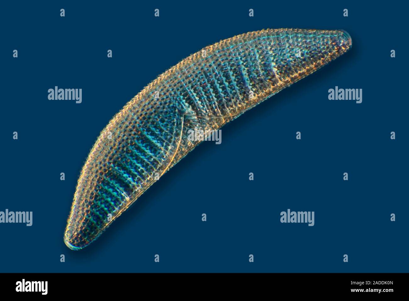 Diatom, light micrograph, Rheinberg illuminated. Diatoms are a group of ...