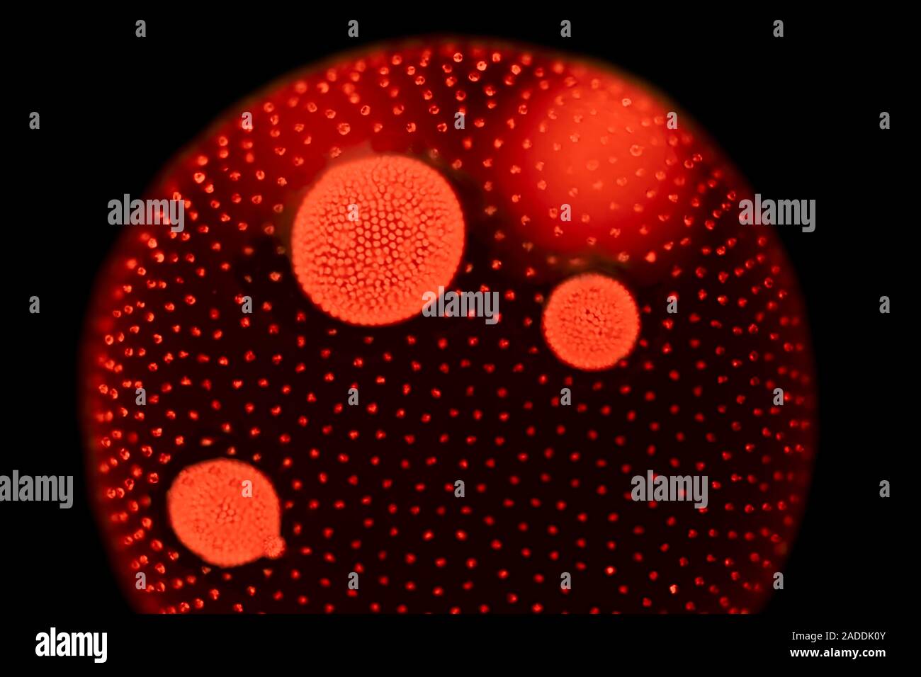 Volvox green algae. Fluorescence illuminated light micrograph of Volvox ...