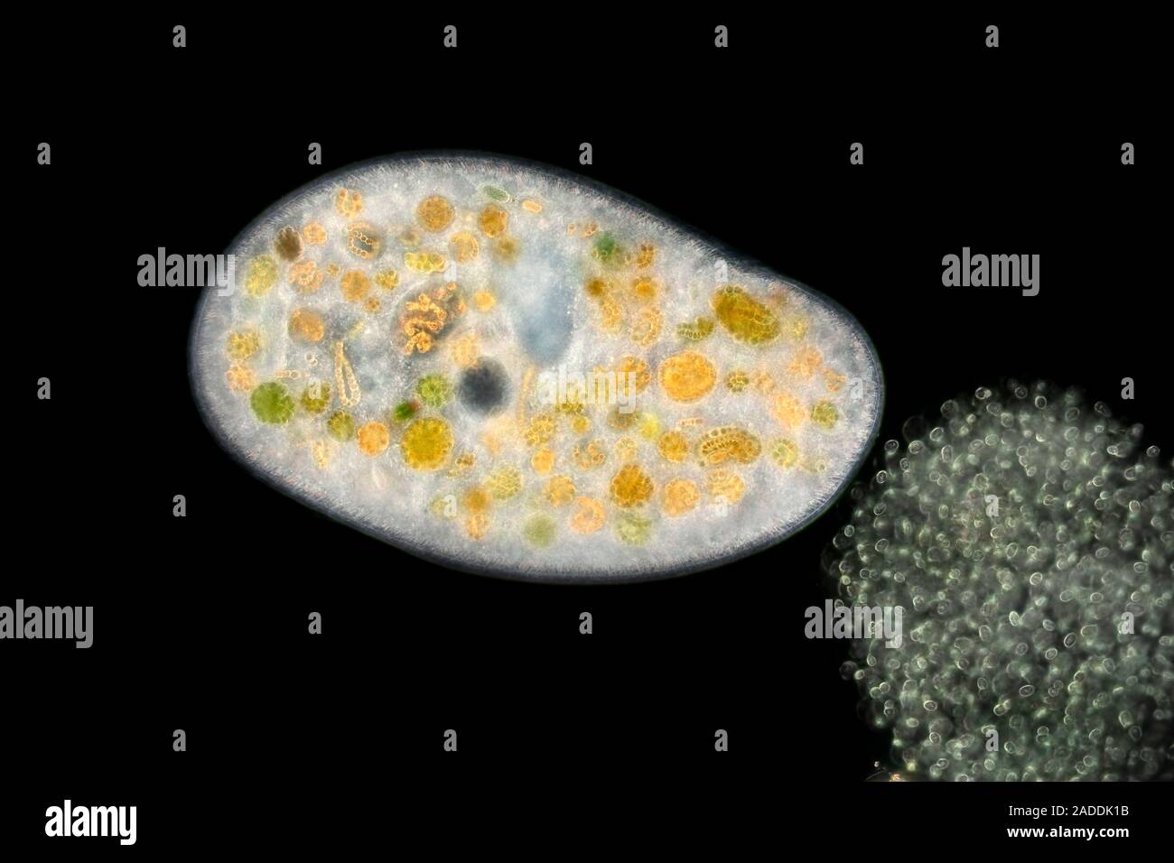 Frontonia sp. ciliate protozoan, light micrograph. A ciliate protozoan ...