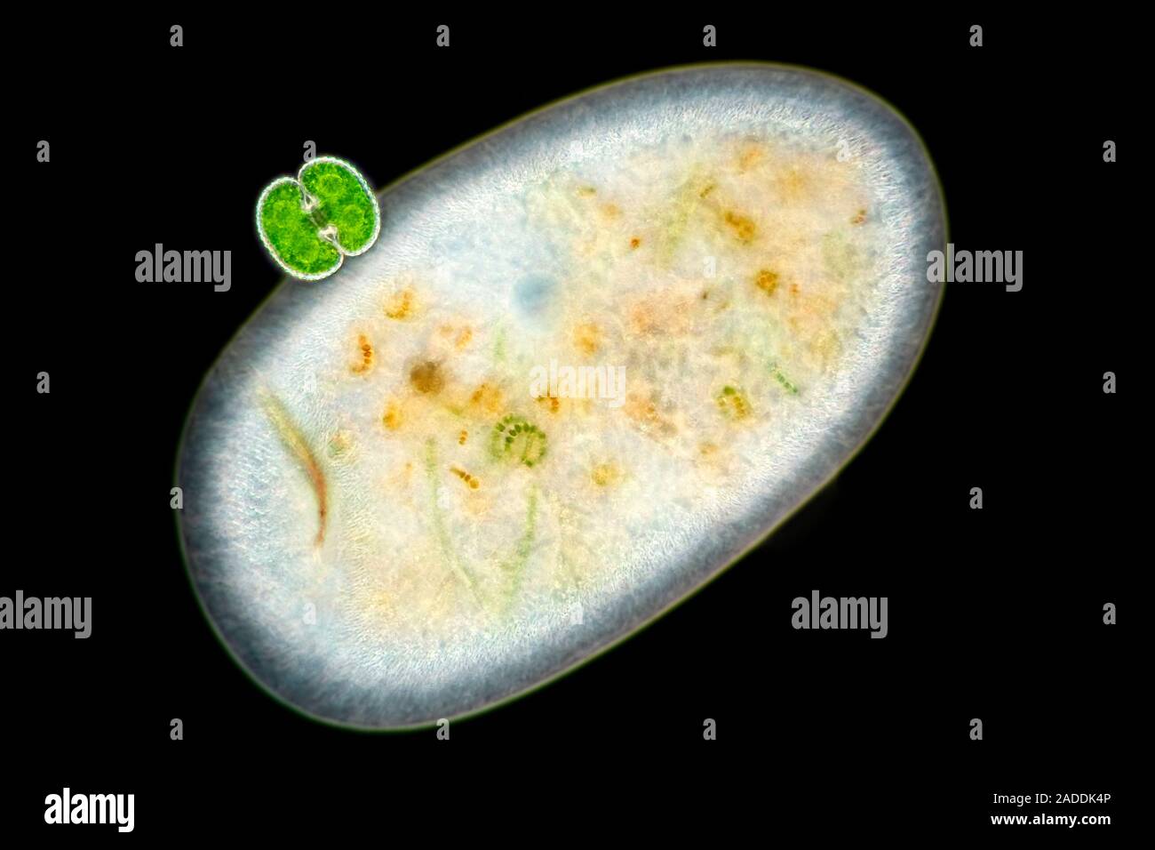 Frontonia sp. ciliate protozoan with algae, light micrograph. A ciliate ...