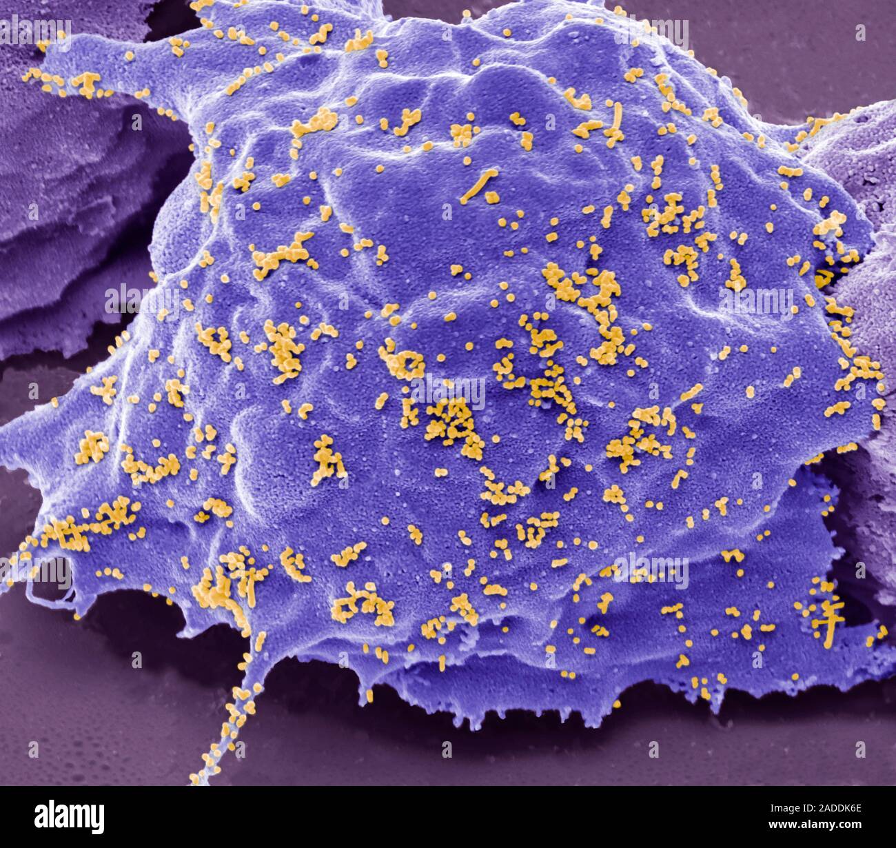 Human cells infected with bird flu virus, coloured scanning electron ...