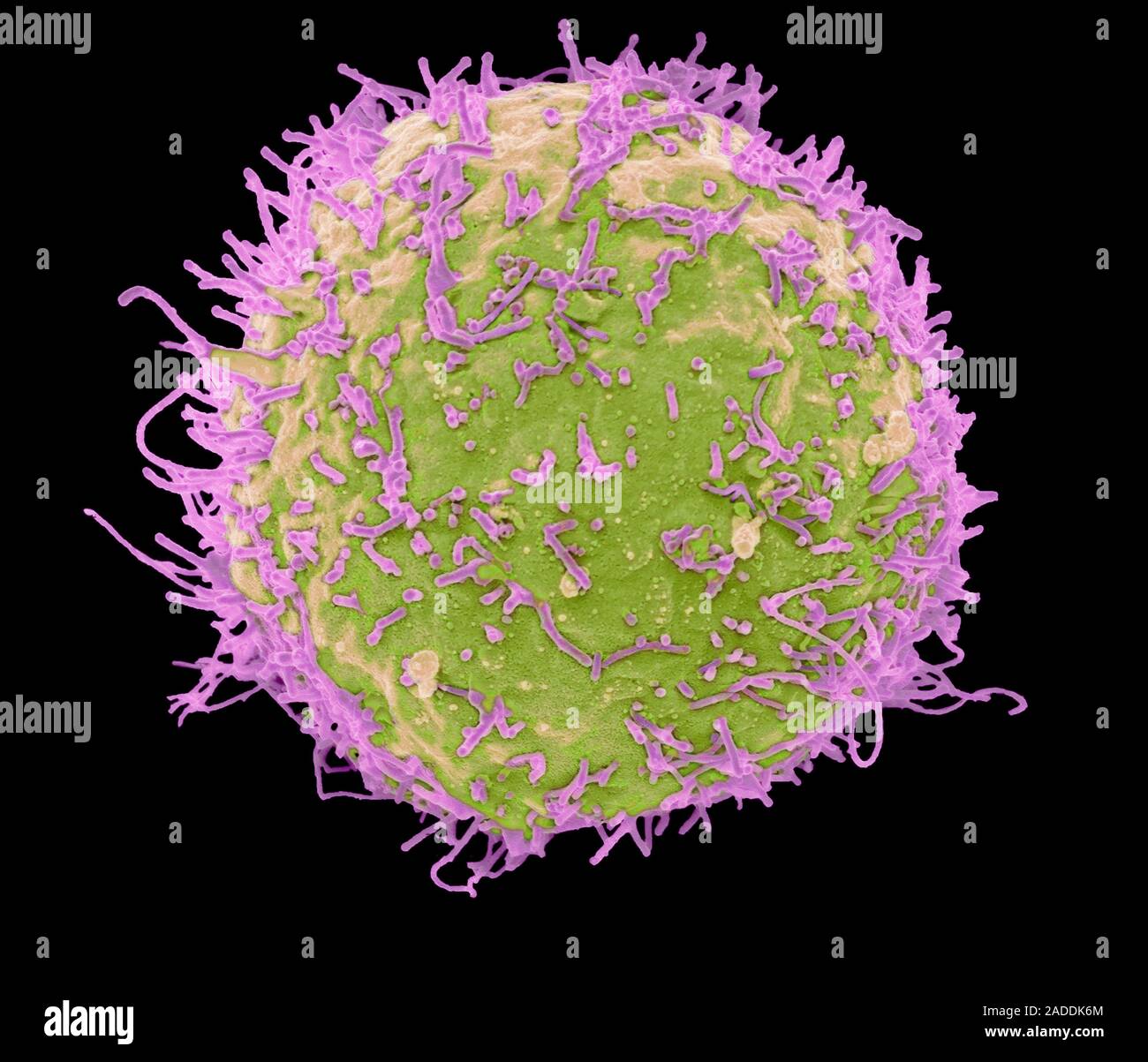 Coloured scanning electron micrograph (SEM) of a human cell infected ...