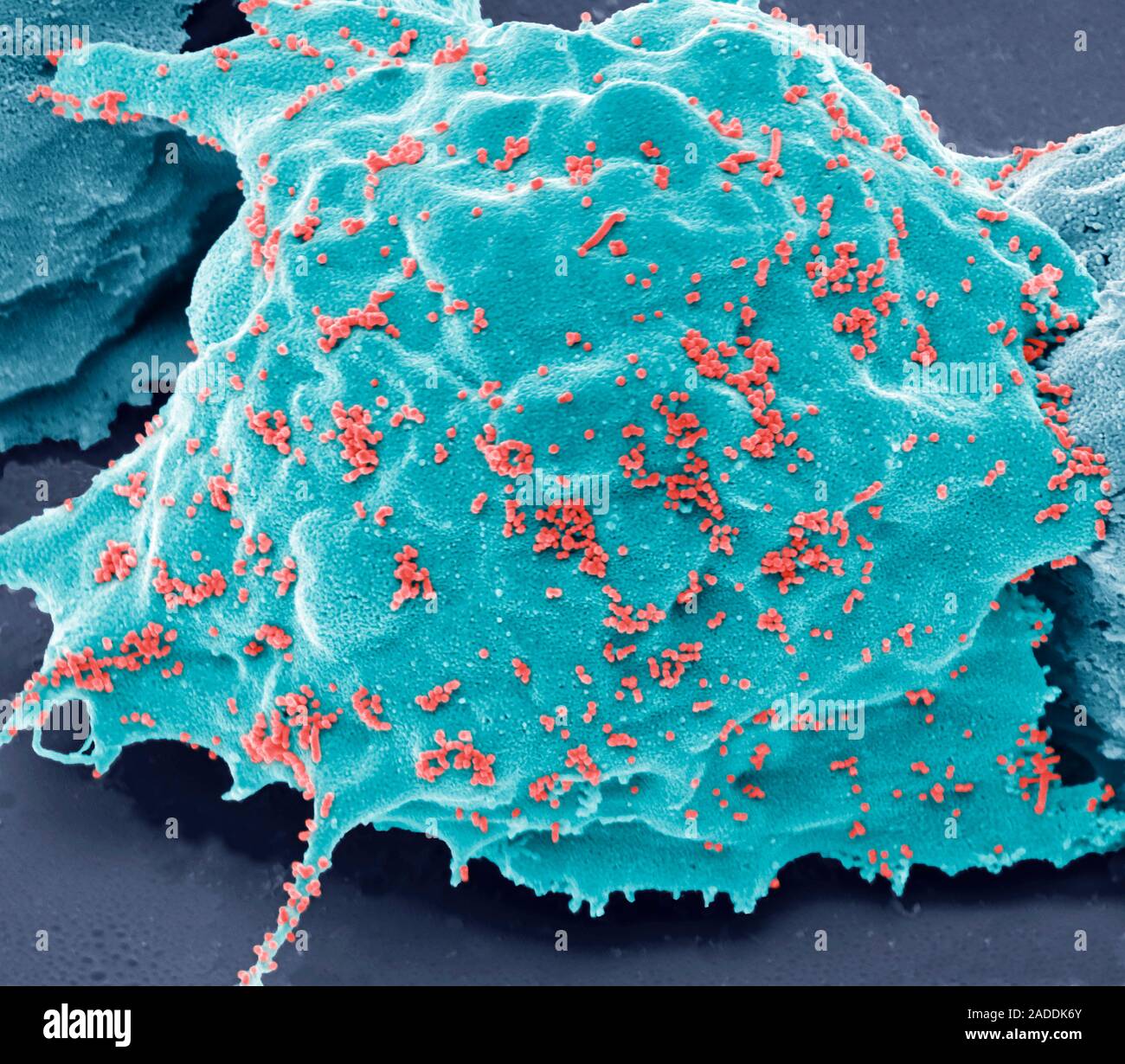 Human cells infected with bird flu virus, coloured scanning electron ...