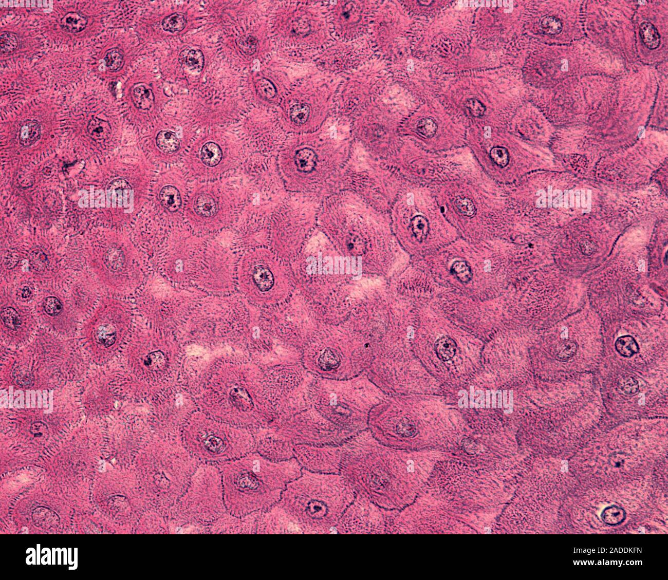 Human skin epidermis. Light micrograph of the stratum spinosum of the ...