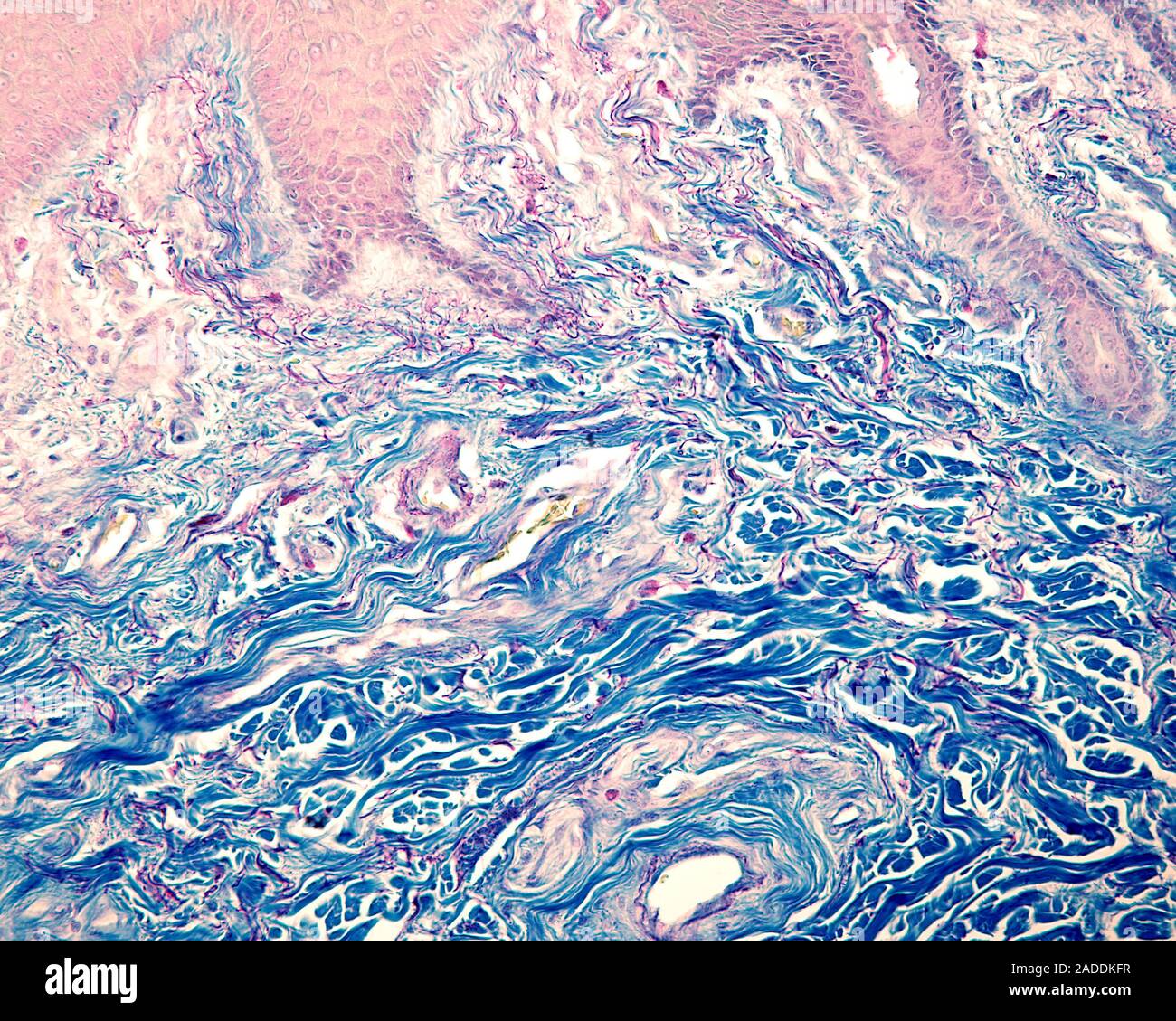 Light micrograph of a section through thick dermis from human skin ...