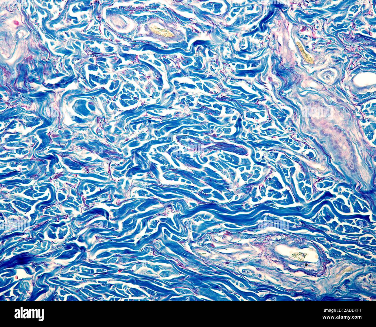 Light micrograph of a section through thick dermis from human skin ...