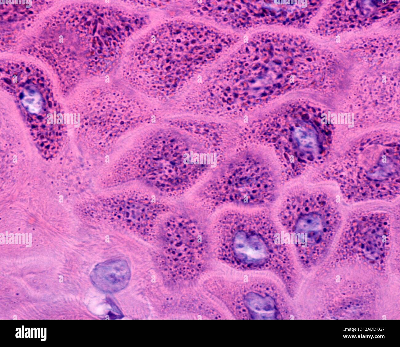 Light micrograph of the epidermis showing the stratum granulosum with ...