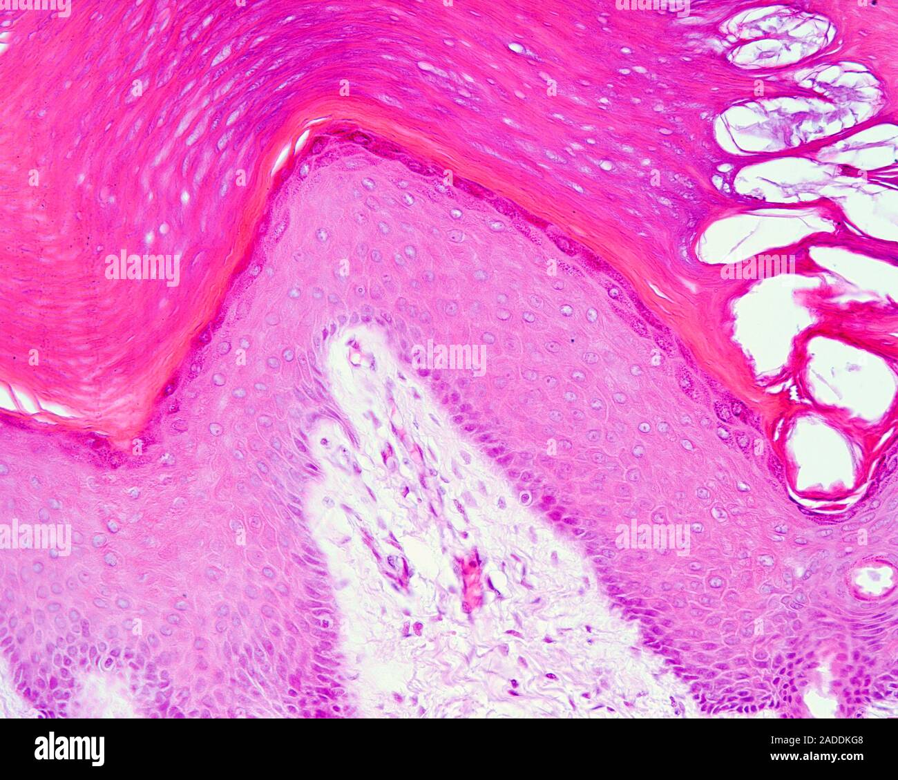 Light micrograph of a section through the epidermis of thick skin. From ...