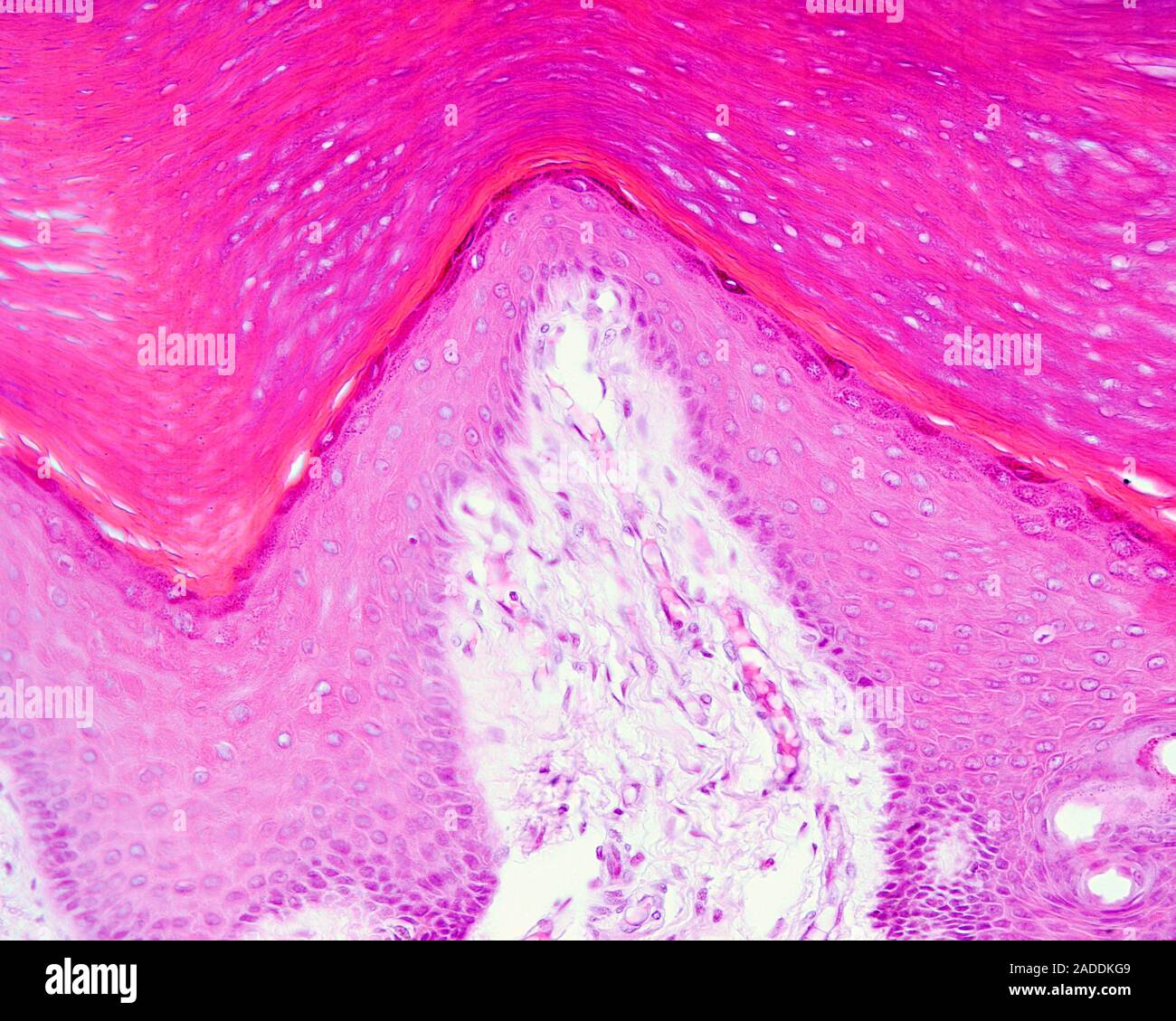 Light micrograph of a section through the epidermis of thick skin. From ...