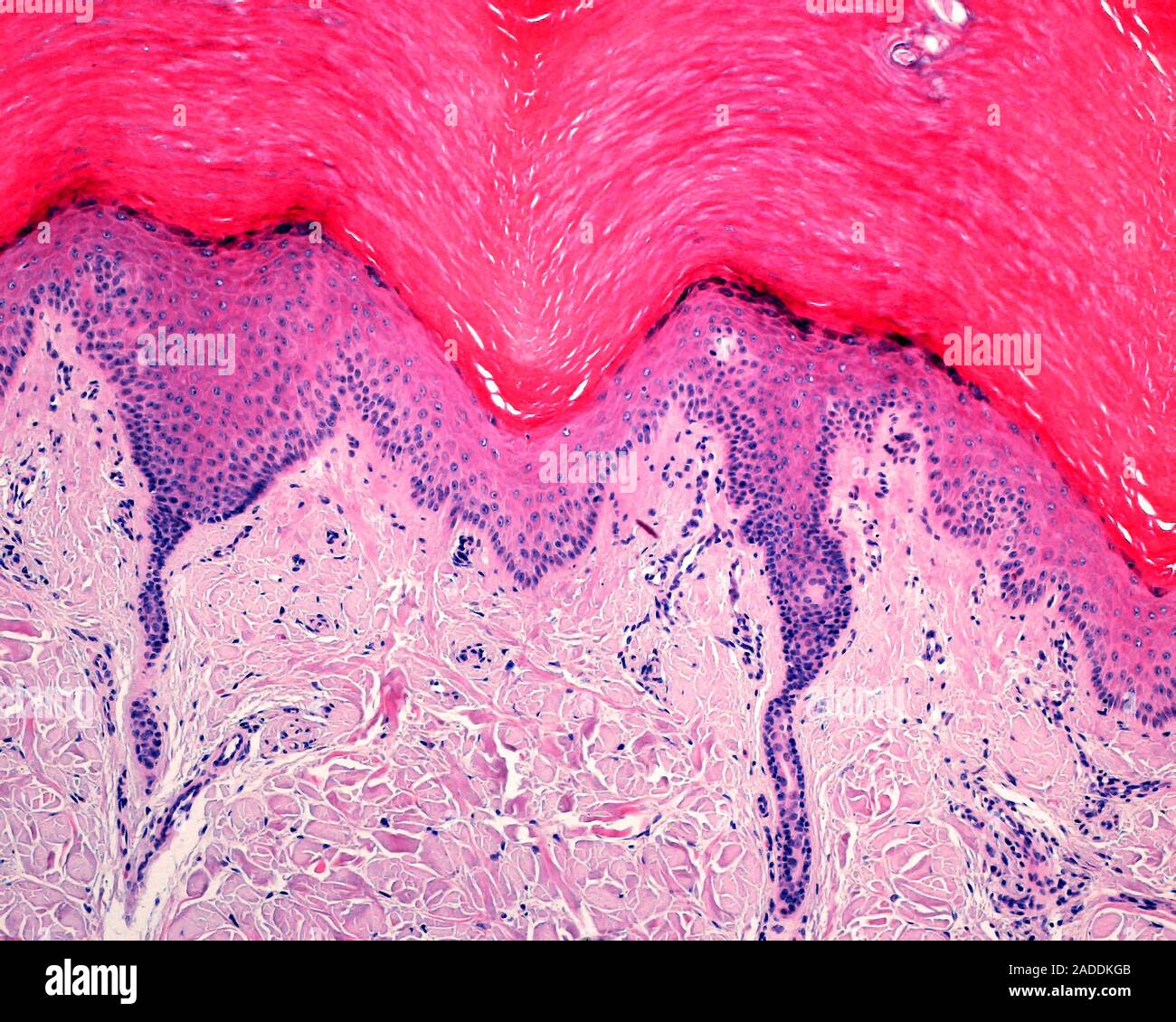Light micrograph of a section through the epidermis of thick skin ...
