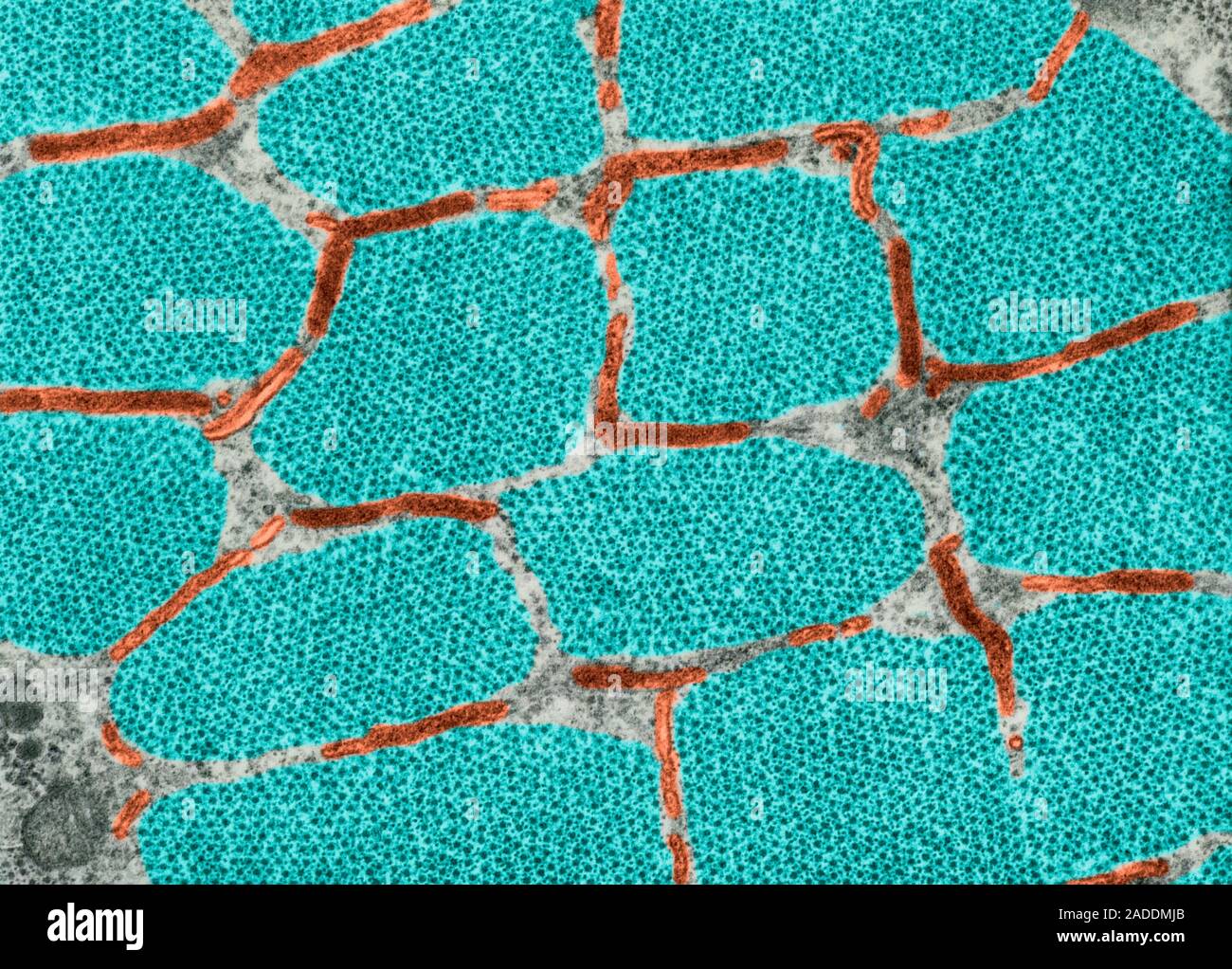 Coloured transmission electron micrograph (TEM) showing muscle myofibrils cross-sectioned at the ...
