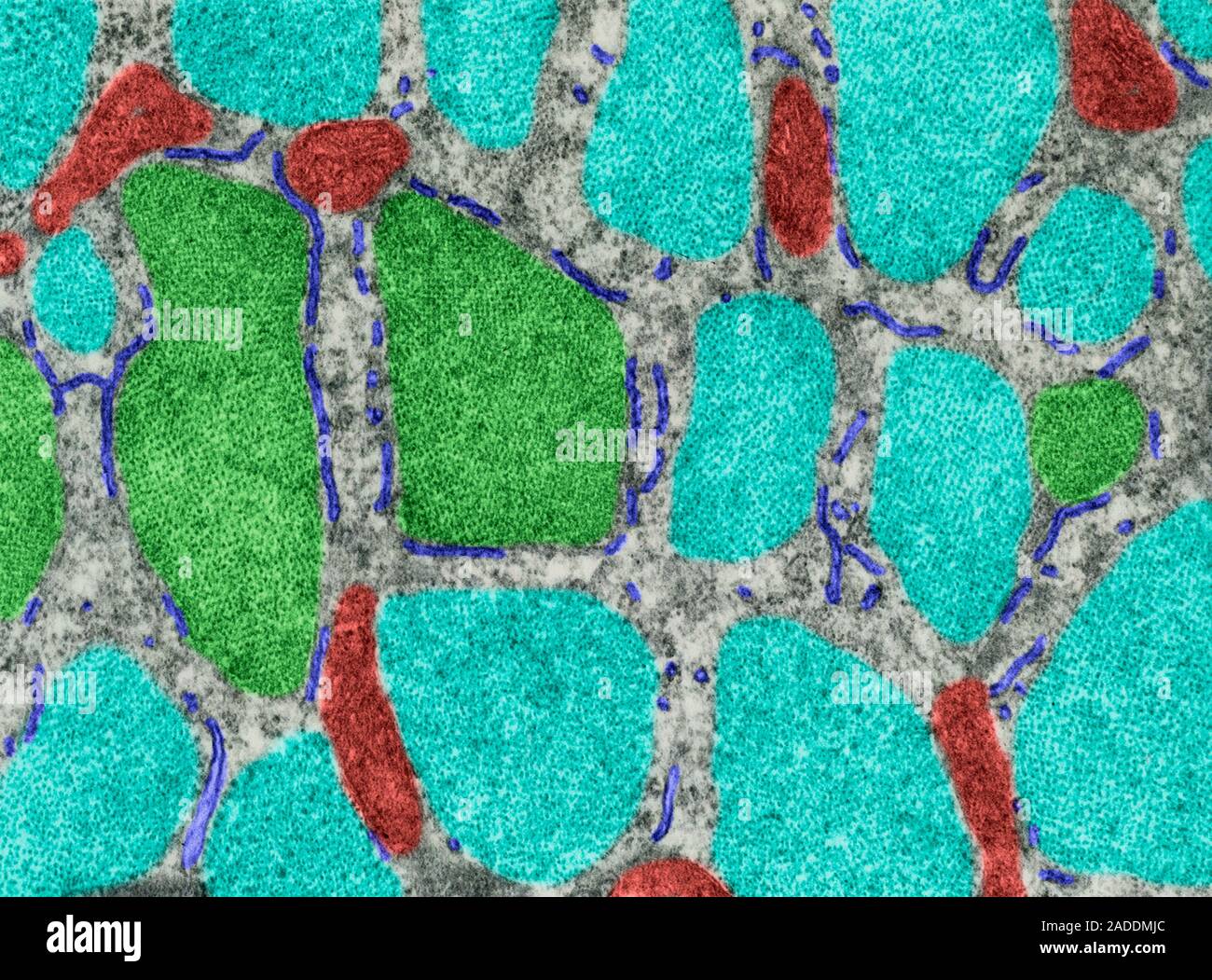 Coloured transmission electron micrograph (TEM) showing the differences between cross-sections ...