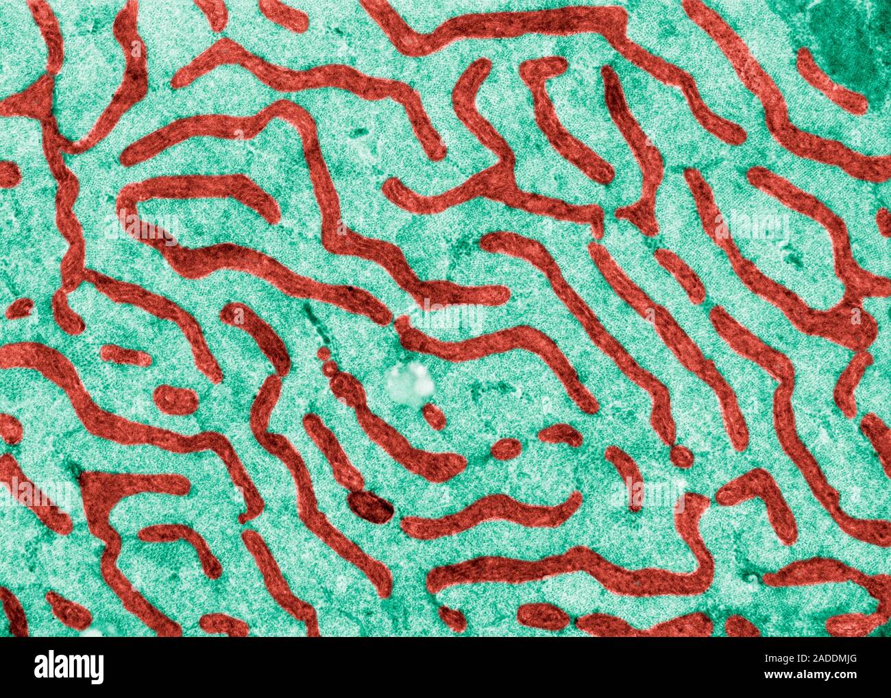 Coloured transmission electron micrograph (TEM) of mitochondria (red) in skeletal striated ...