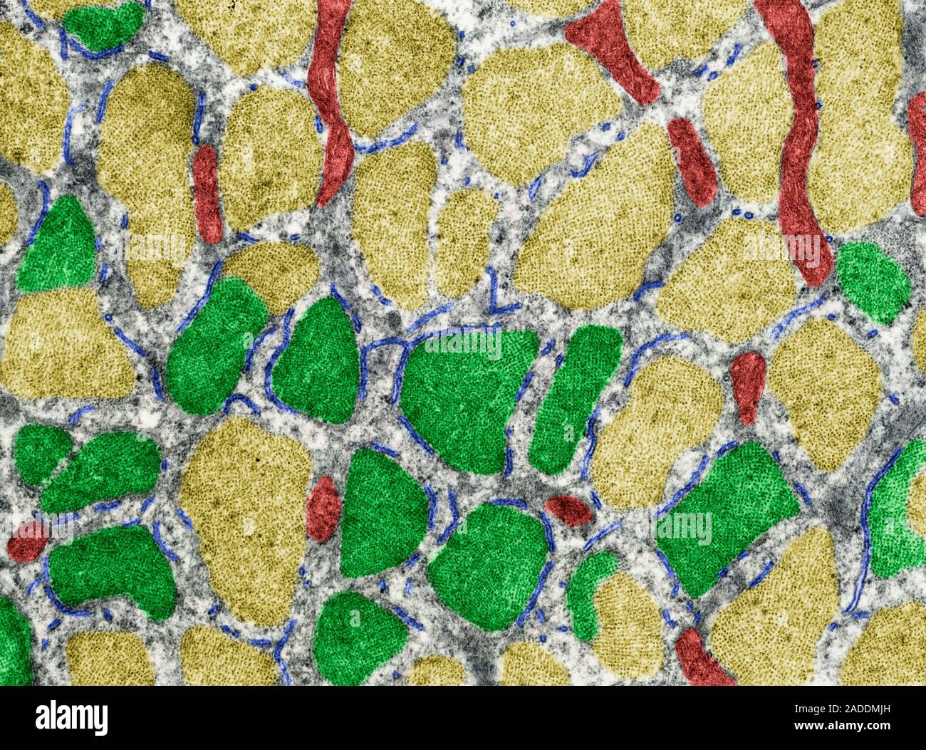 Coloured transmission electron micrograph (TEM) showing the differences between cross-sections ...