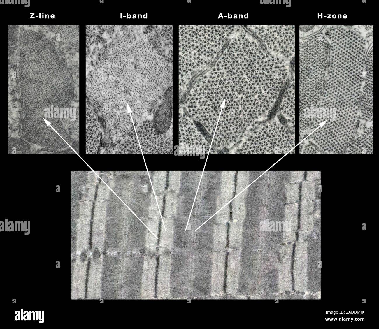 Transmission electron micrographs (TEM) showing muscle fibre sarcomere ...