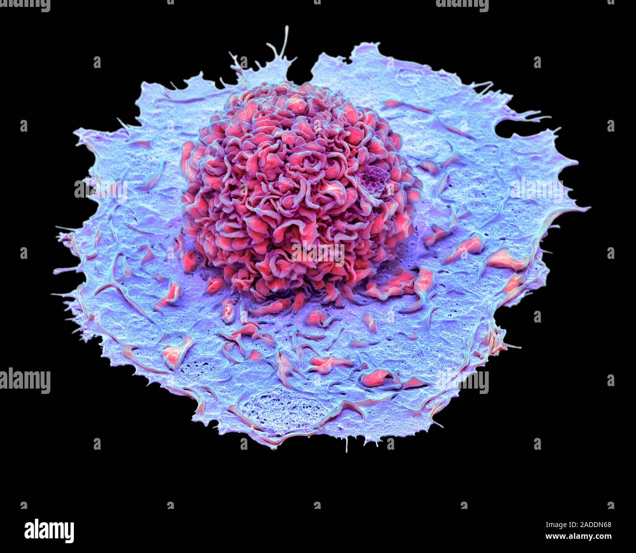 Macrophage. Coloured scanning electron micrograph (SEM) of a macrophage white blood cell ...
