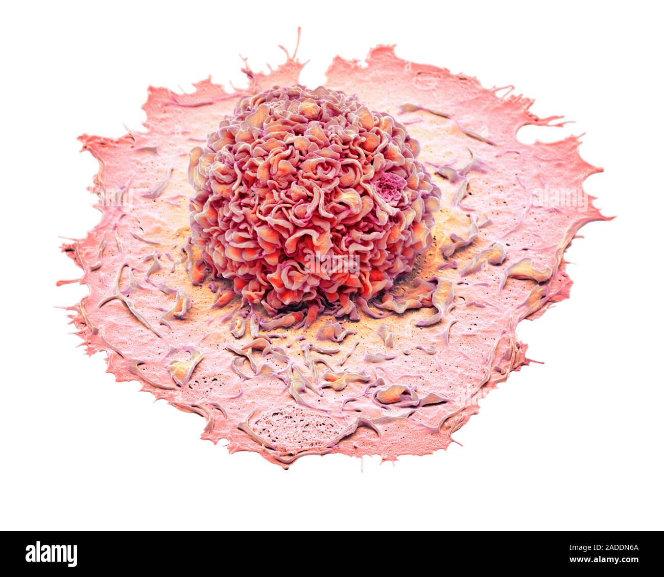 Macrophage. Coloured scanning electron micrograph (SEM) of a macrophage white blood cell ...