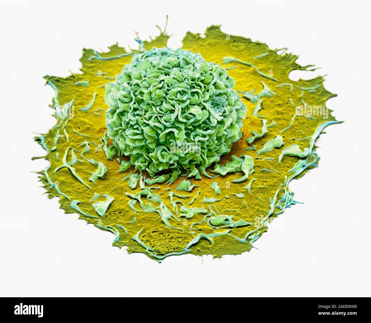 Macrophage. Coloured scanning electron micrograph (SEM) of a macrophage ...