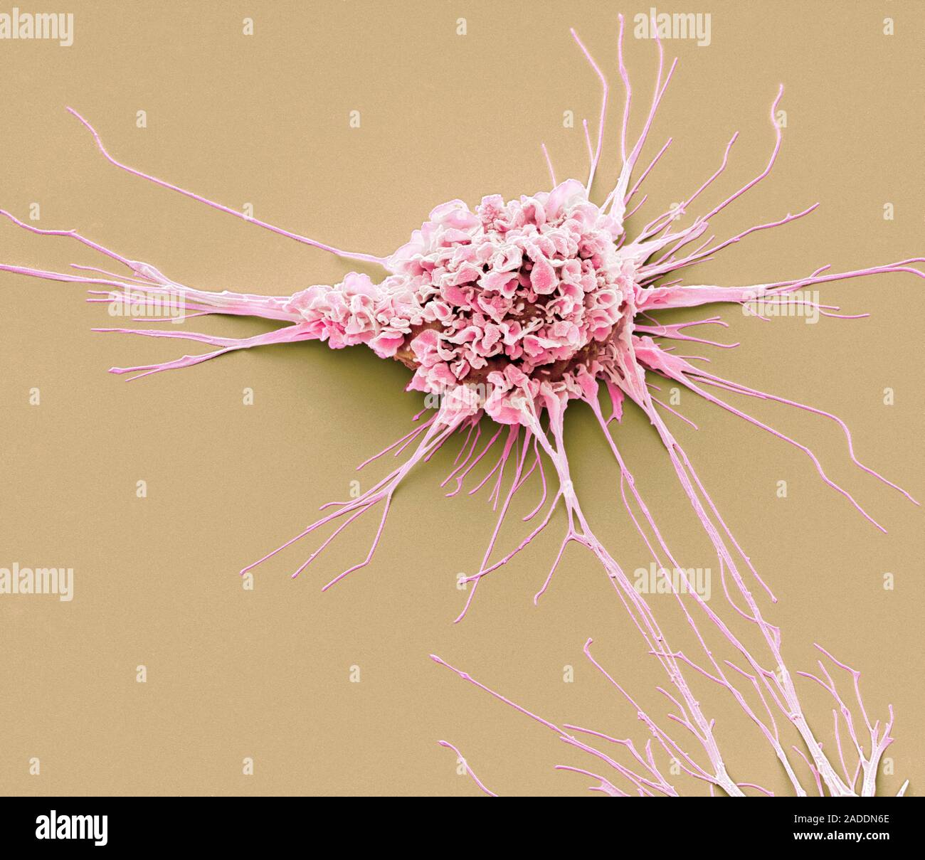 Dendritic cell. Coloured scanning electron micrograph (SEM) of a ...