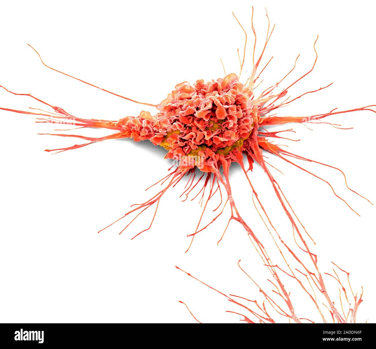 Dendritic cell. Coloured scanning electron micrograph (SEM) of a ...