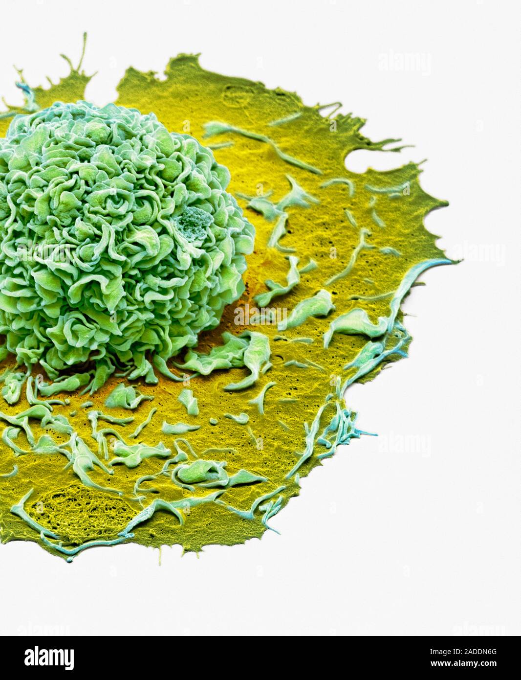 Macrophage. Coloured scanning electron micrograph (SEM) of a macrophage white blood cell ...