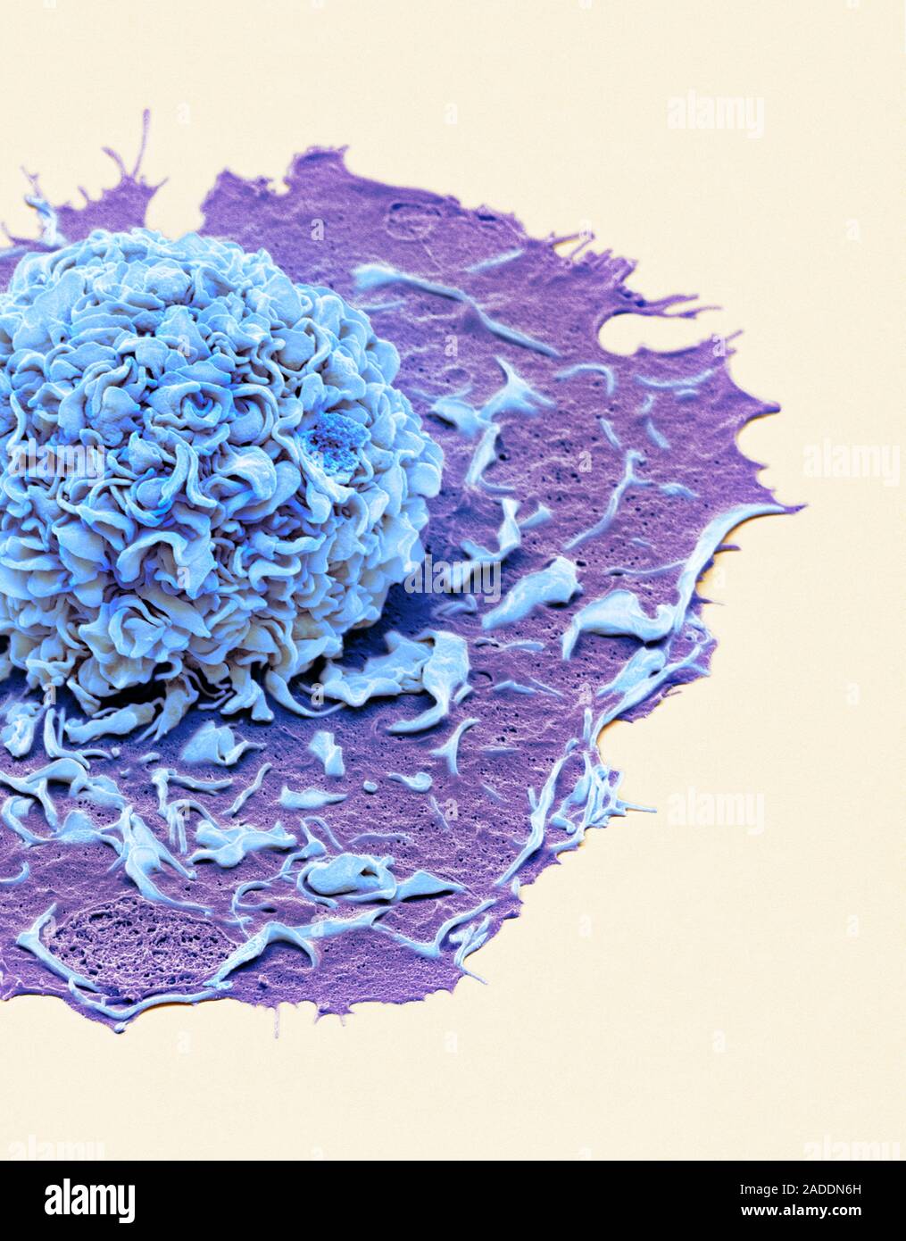 Macrophage. Coloured scanning electron micrograph (SEM) of a macrophage white blood cell ...